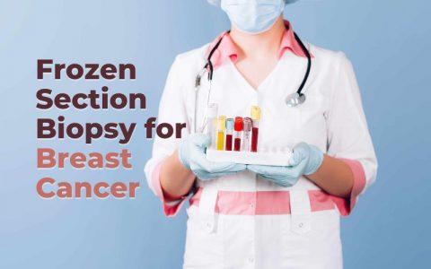 Frozen Section Biopsy: Breast Cancer