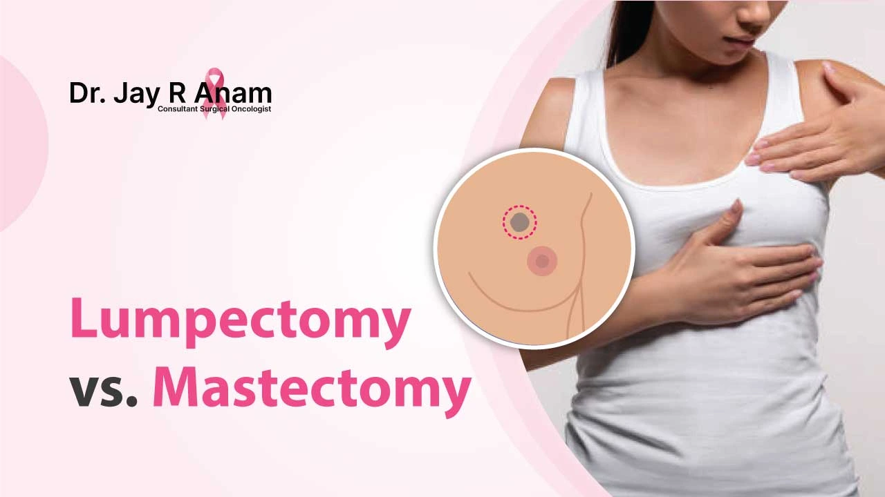 Lumpectomy vs. Mastectomy | Dr.Jay Anam